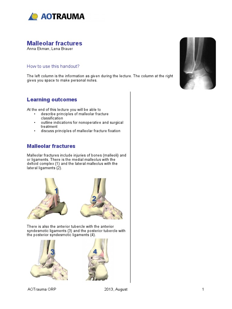 Malleolar Fracture Management Guide | PDF | Ankle | Anatomical Terms Of ...