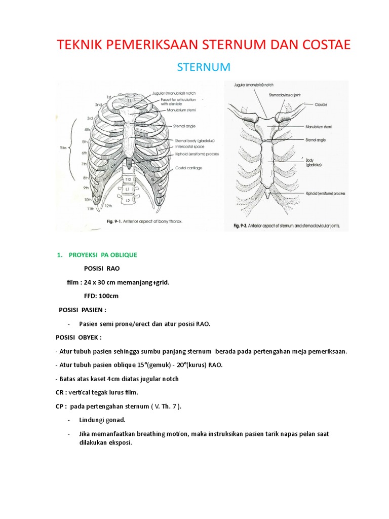 Teknik Pemeriksaan Sternum Dan Costae | PDF