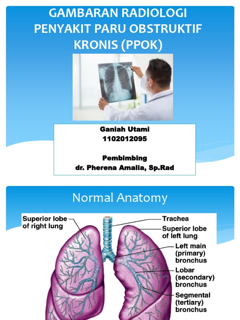 Gambaran Radiologi Ppok Gan | PDF