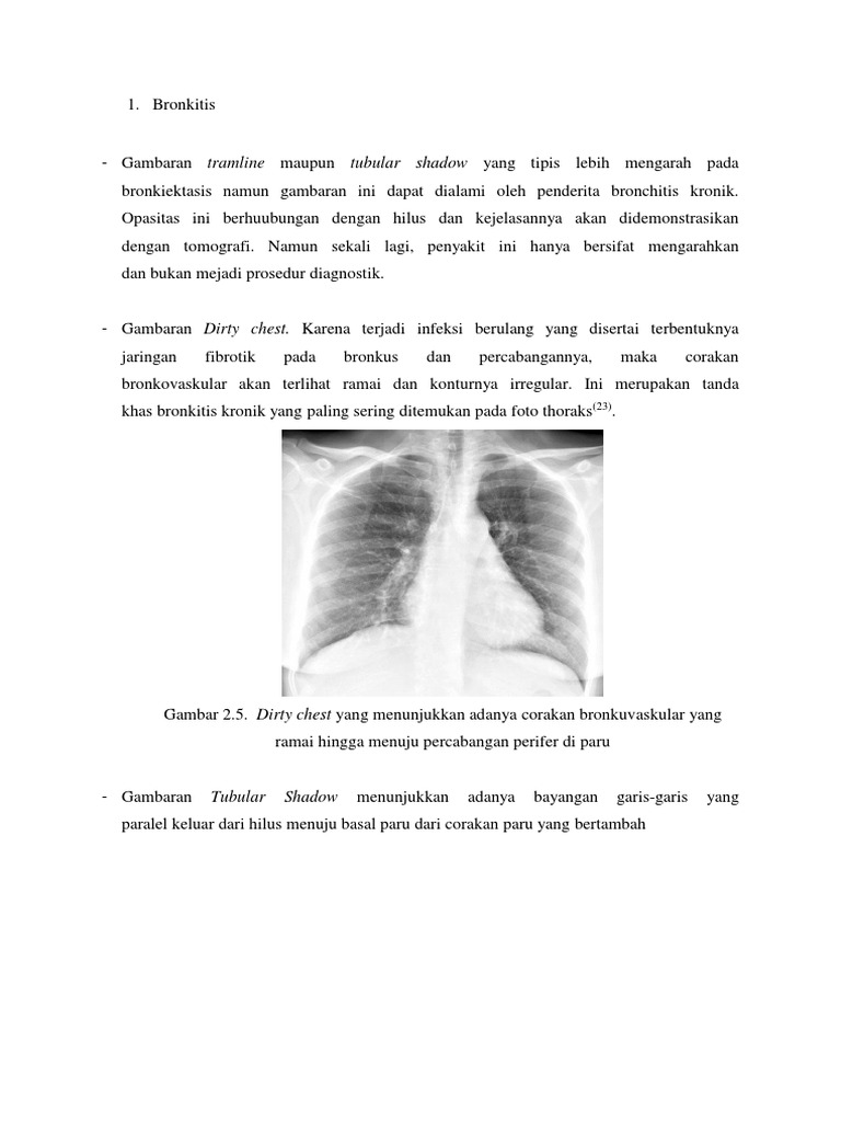 Bronkitis | PDF | Ilmu Sosial | Seni