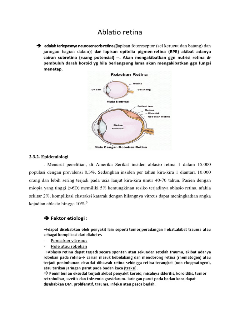 Ablatio Retina | PDF