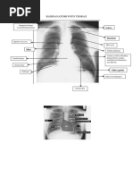 Anatomi Thorax Normal pada Rontgen | PDF