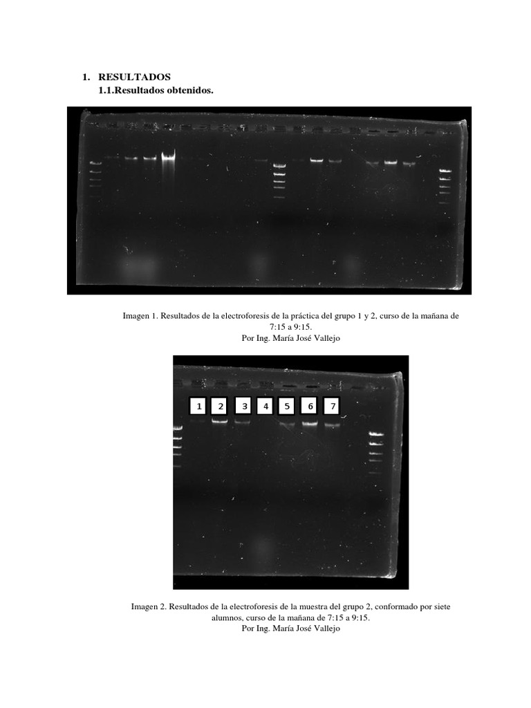 Informe-Electroforesis 1 | PDF | Adn | Electroforesis