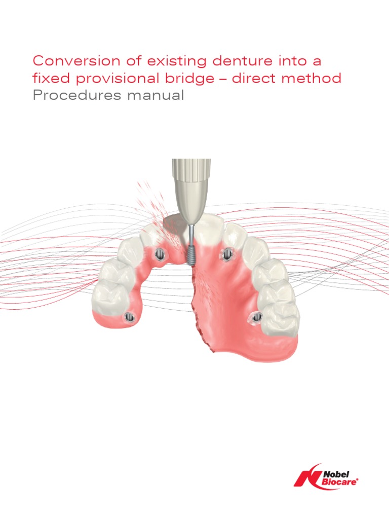 Denture Conversion Manual 16.1 GB | PDF | Dental Implant | Dentures