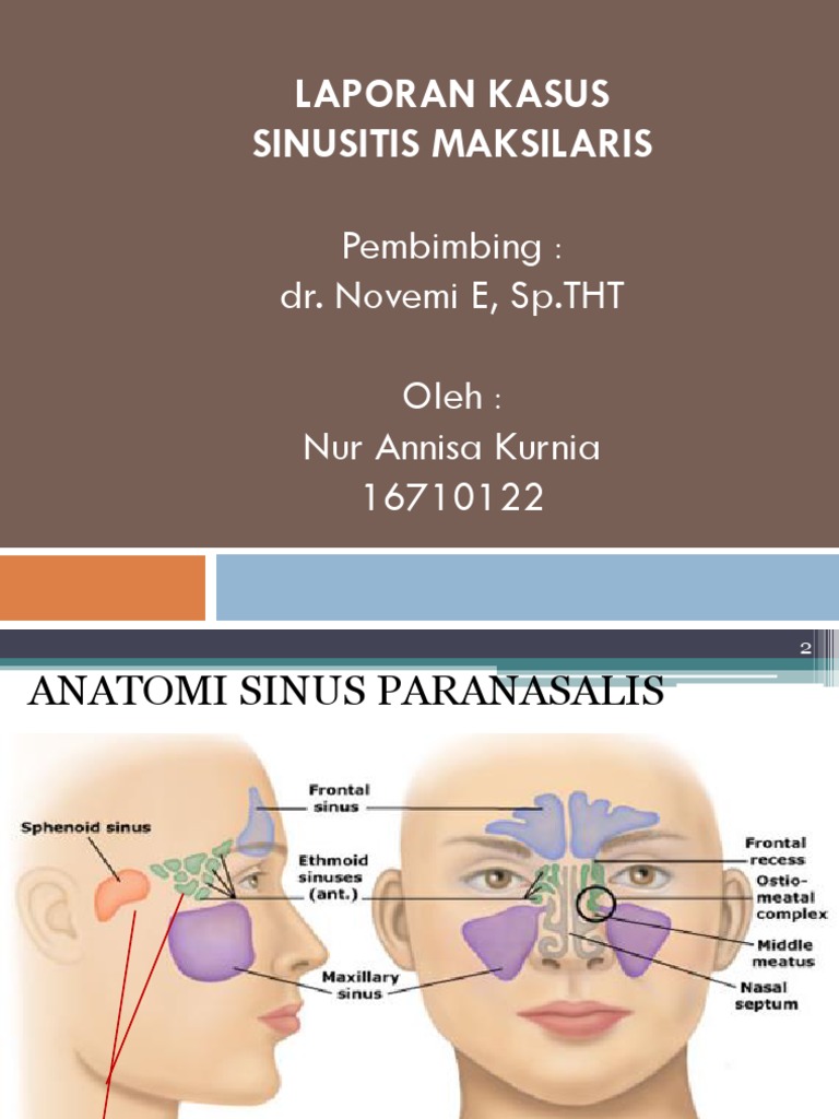 Laporan Kasus Sinusitis | PDF