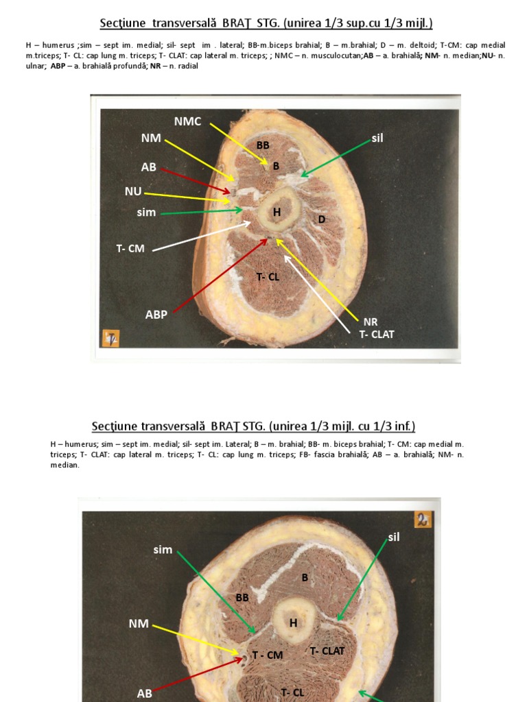 Sectiuni An.i, Sem.I (1w66754 | PDF