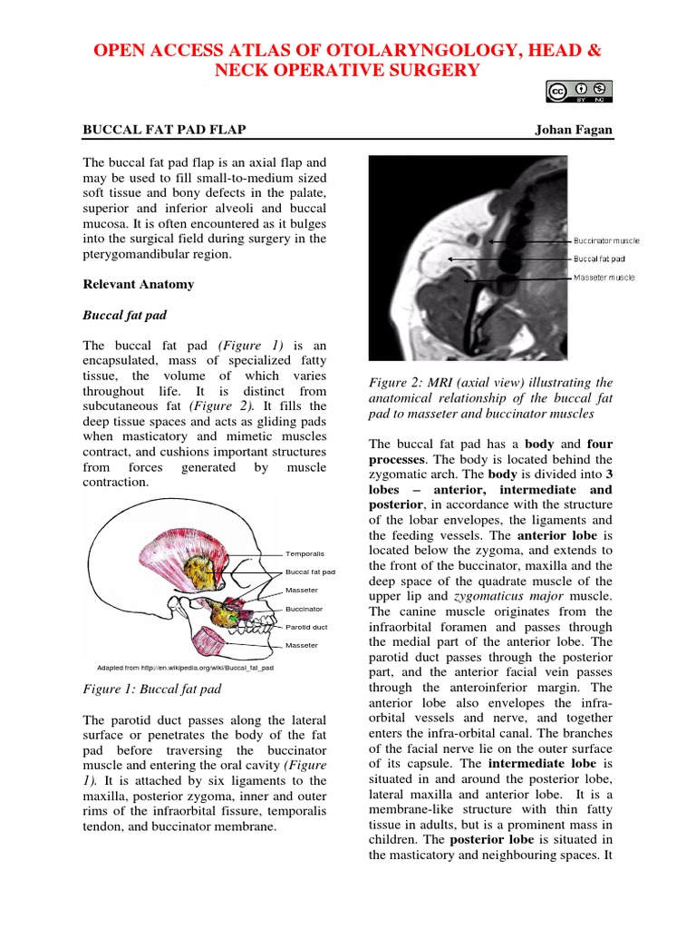 Buccal Fat Pad Flap-1 | PDF | Anatomical Terms Of Location | Human Head ...