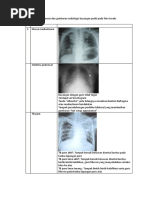 Anatomi Thorax Normal + Gambaran Radiologi | PDF