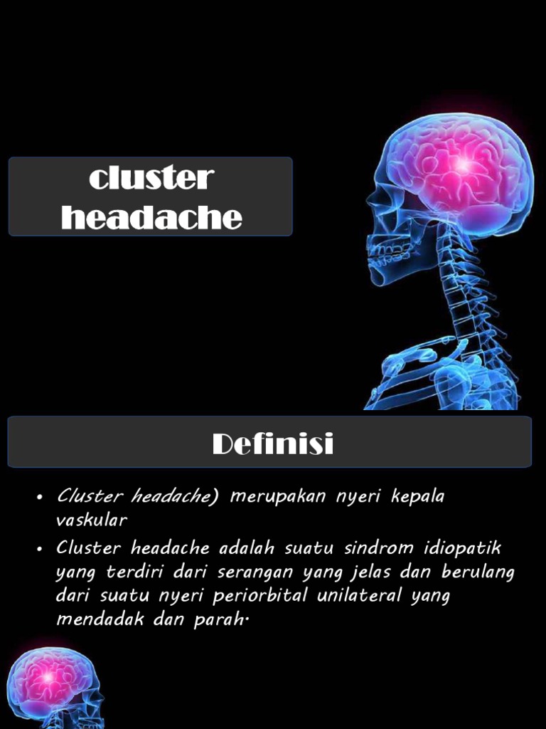 Cluster Headache | PDF