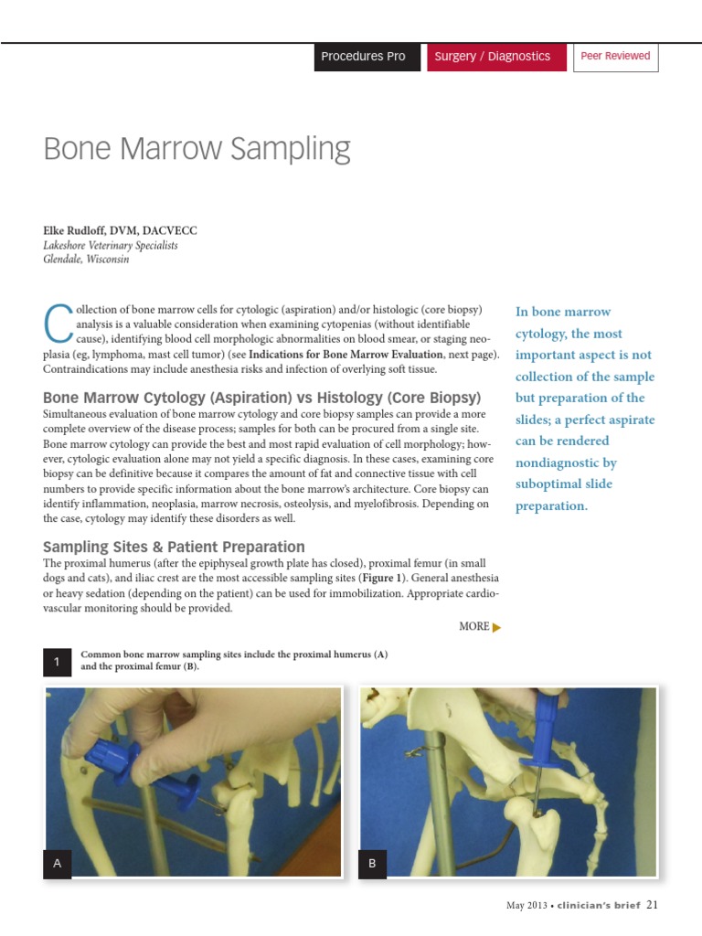 Bone Marrow Sampling: Bone Marrow Cytology (Aspiration) Vs Histology ...