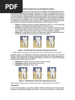 Clasificación de Seibert Los Defectos Del Reborde Alveolar | PDF