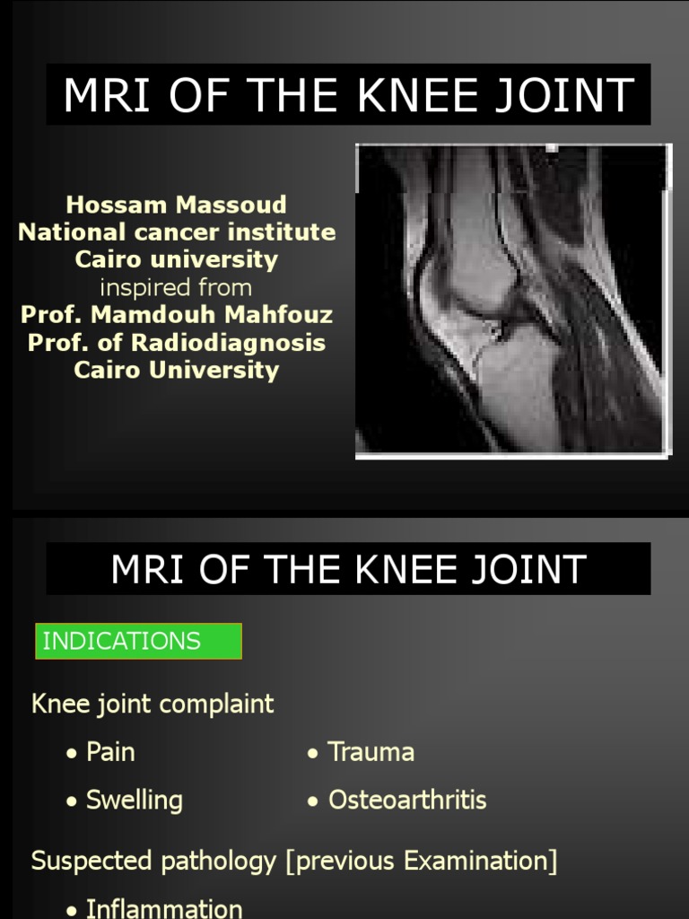 Mri Knee | PDF | Knee | Limbs (Anatomy)