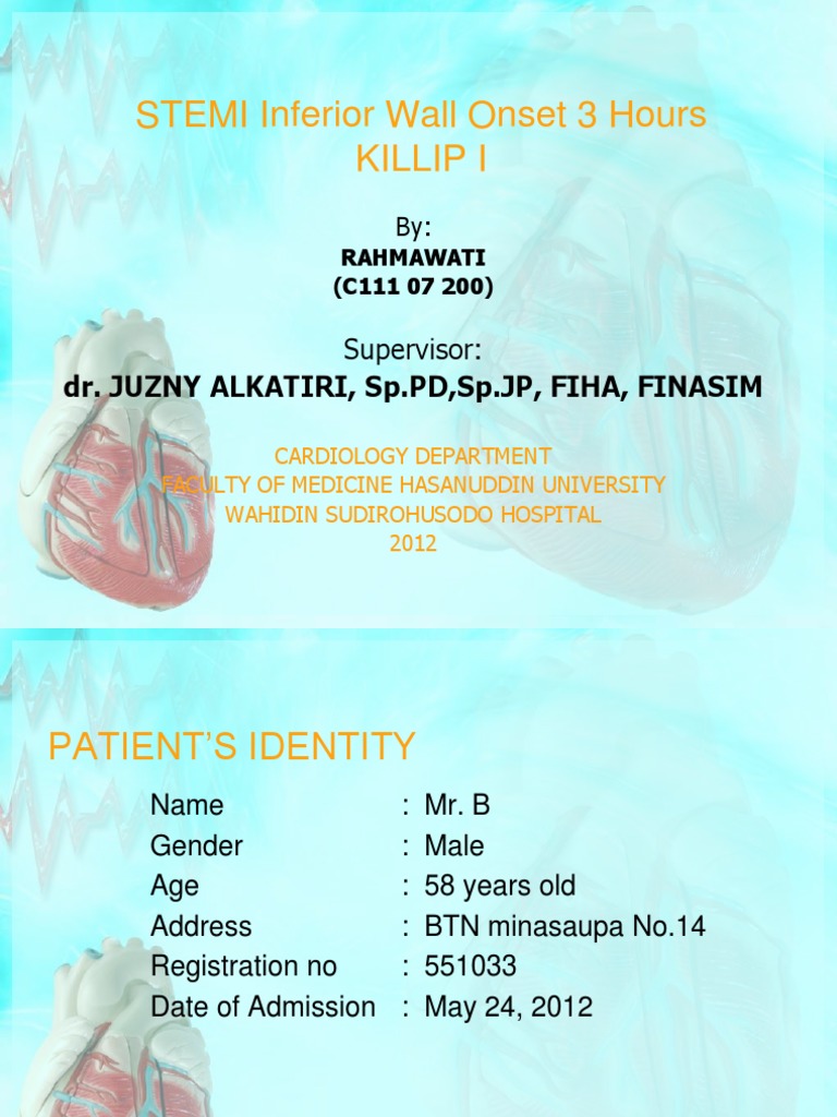 STEMI Inferior Wall Onset 3 Hours Killip I: Dr. Juzny Alkatiri, SP - PD ...
