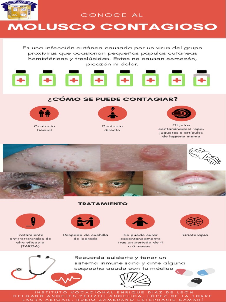 Molusco Contagioso | PDF