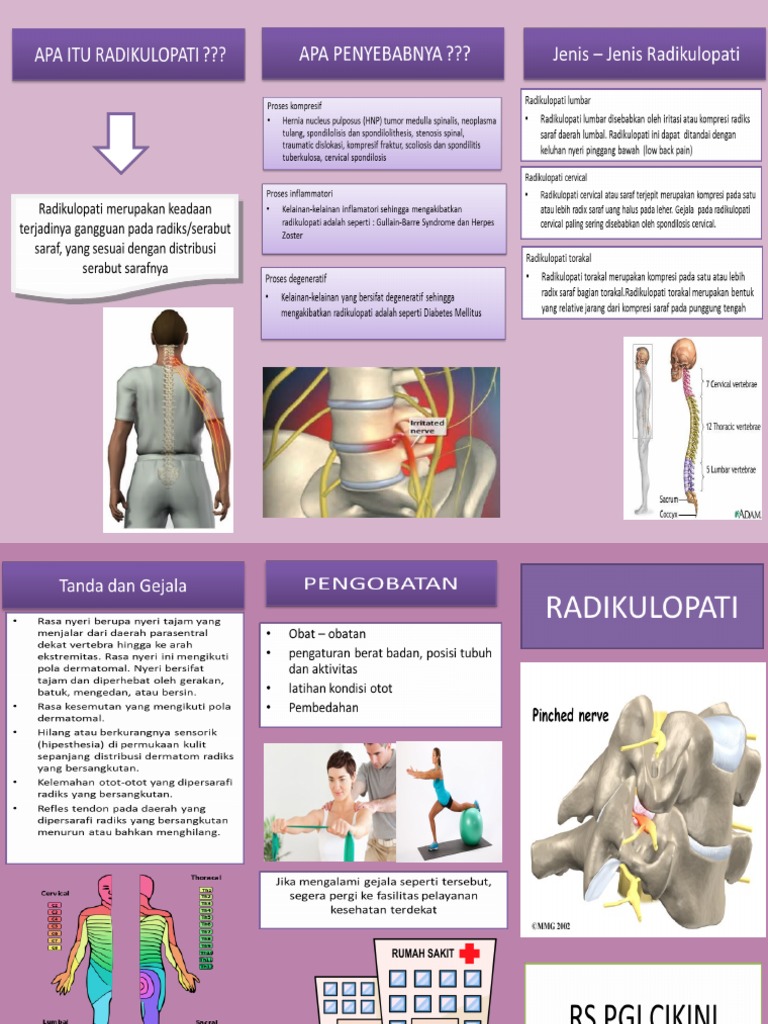 Leaflet Radikulopati | PDF