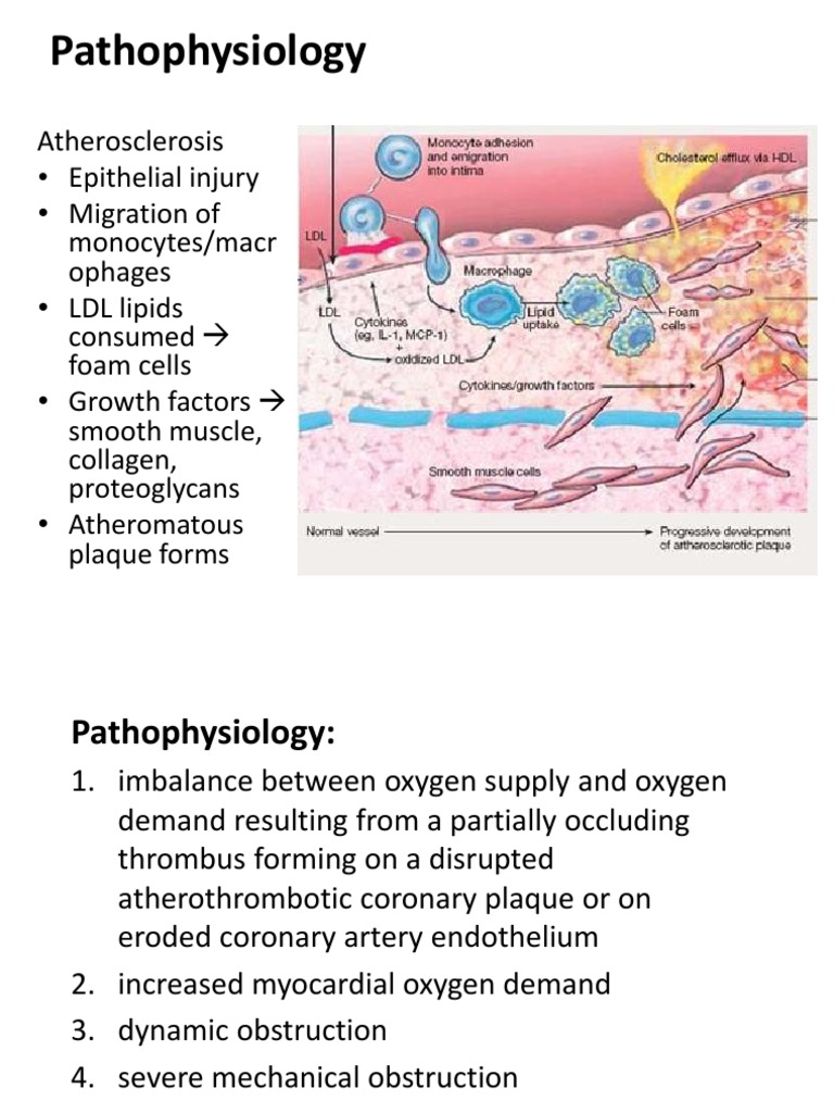 NSTEMI Pathophysiology Overview | PDF