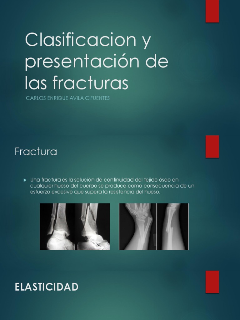 Clasificacion y Presentación de Las Fracturas | Lesión | Hueso
