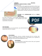 Guía sobre Cromoniquia y Alteraciones Ungueales | PDF | Clavo (anatomía ...