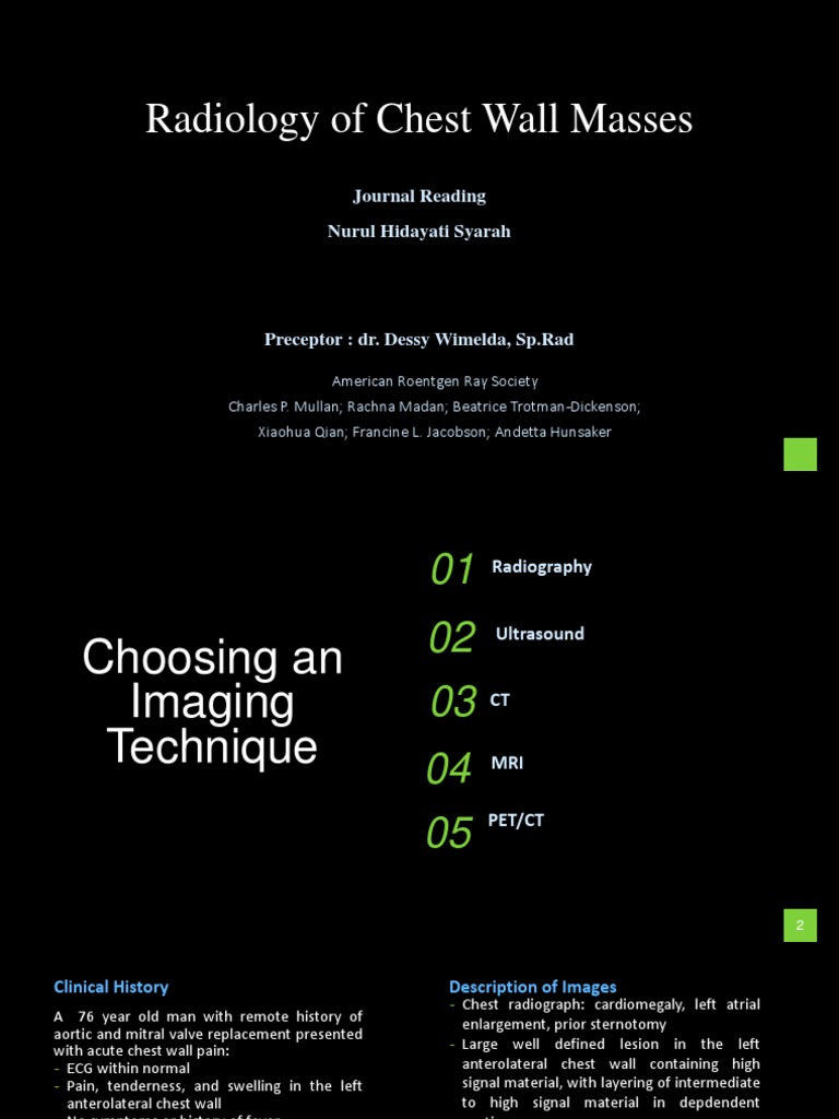 Chest Wall Mass Imaging Guide | PDF | Vertebra | Medical Imaging