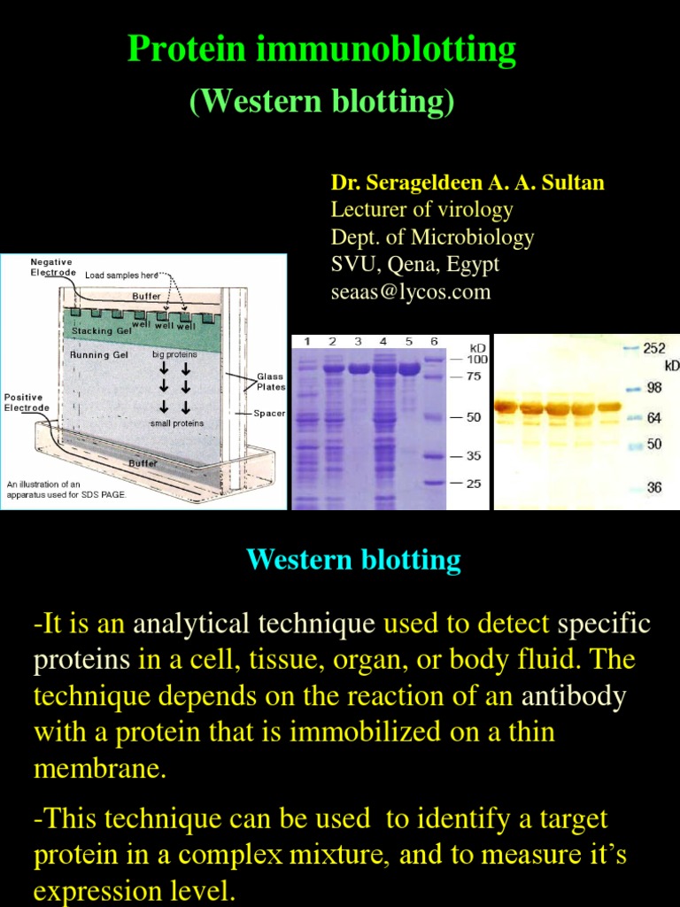Protein Immunoblotting: (Western Blotting) | PDF | Western Blot ...