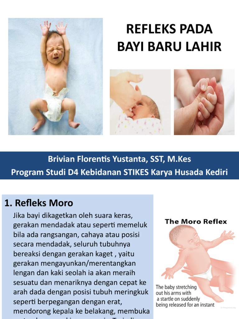 Refleks Pada Bayi Baru Lahir (BBL) | PDF