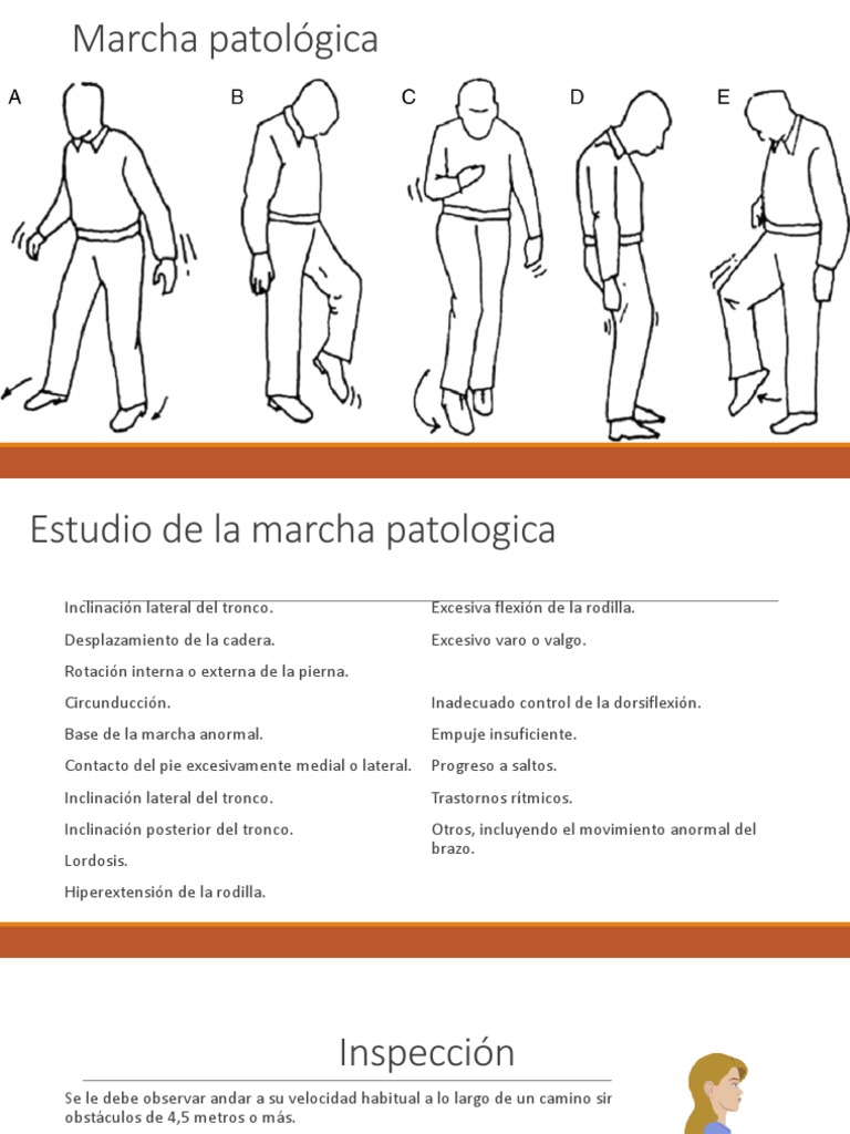 Marcha Patologica | PDF | Pie | Sistema musculoesquelético