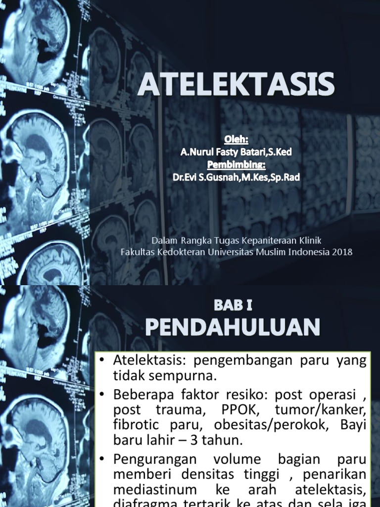 ATELEKTASIS | PDF