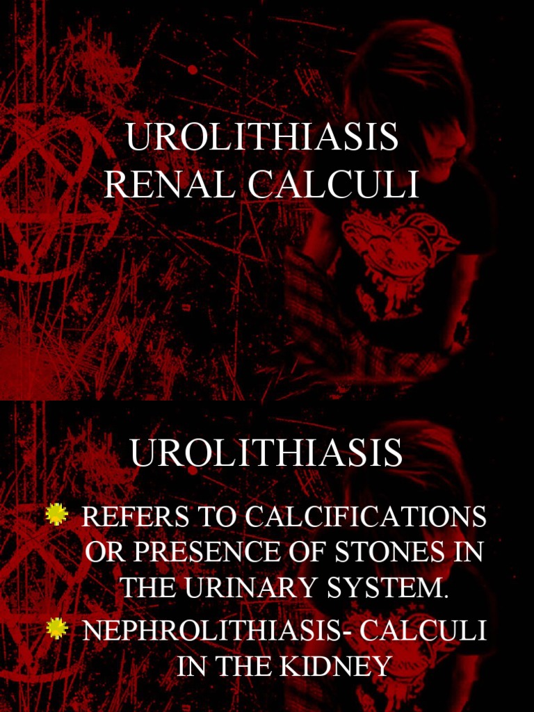 Urolithiasis Renal Calculi | PDF | Kidney | Organ (Anatomy)