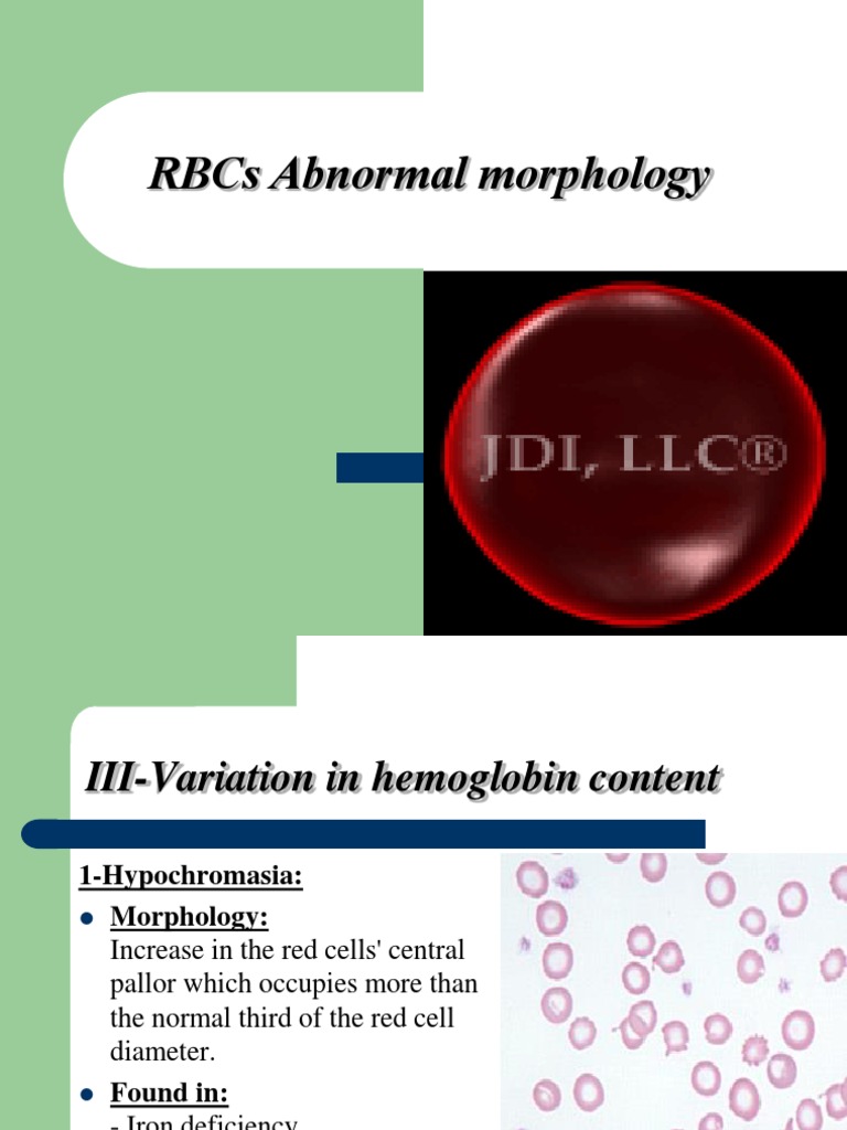 A Comprehensive Guide to Abnormal Red Blood Cell Morphologies | PDF ...