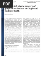 Classification of Dental Surface Defects in Areas of Gingival Recession ...