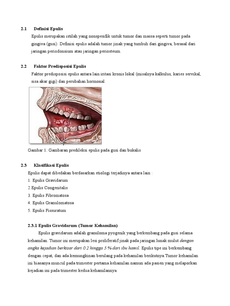 Epulis | PDF | Sains & Matematika