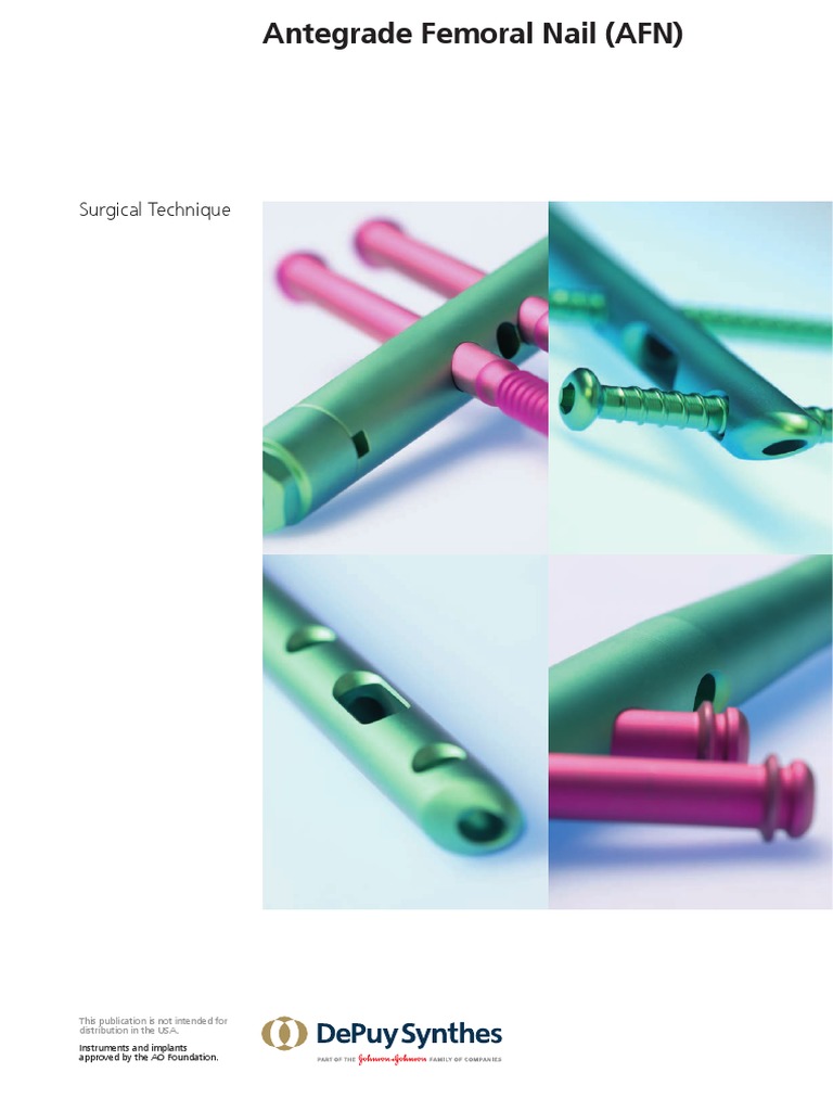 Antegrade Femoral Nail (AFN) | PDF | Screw | Hip