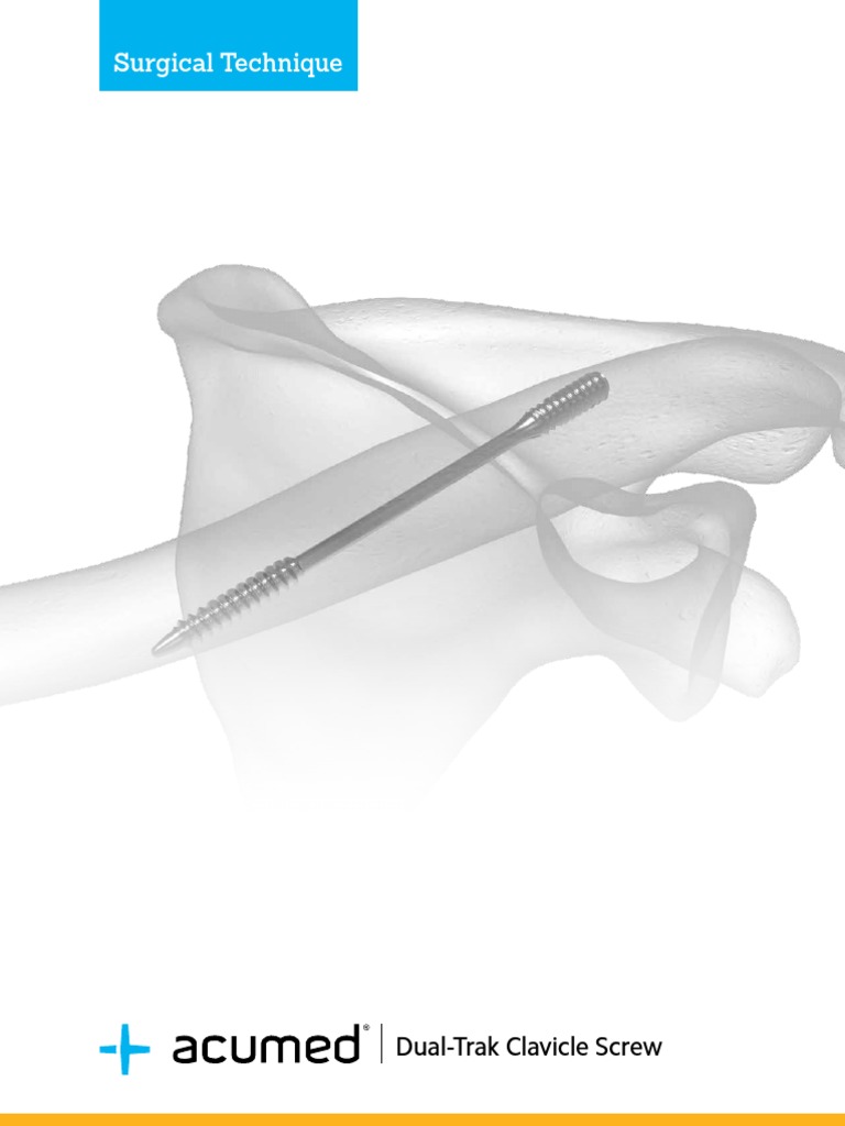 Acumed® Dual-Trak Clavicle Screw | PDF | Screw | Surgery