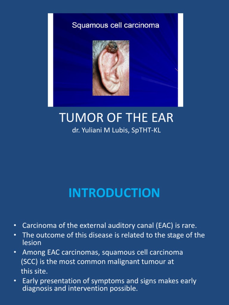 Ear Carcinoma | PDF | Ear | Carcinoma