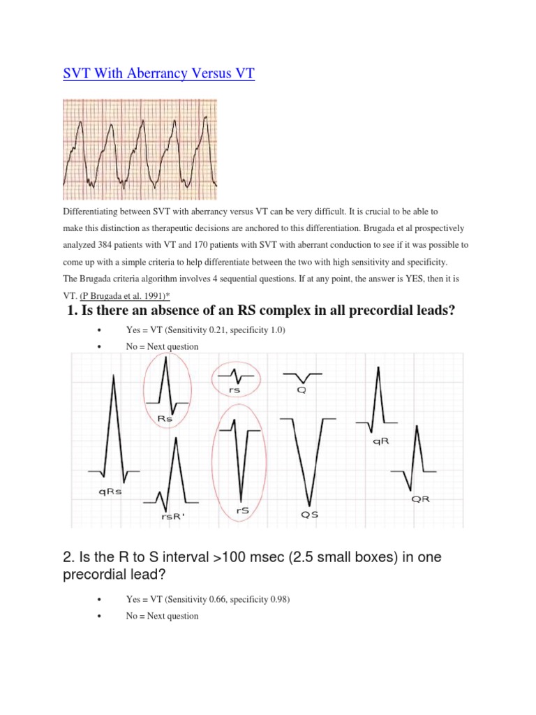 SVT With Aberrancy Versus VT | PDF | Electrocardiography | Atrium (Heart)