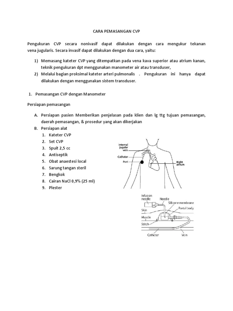 Checklist CVP | PDF