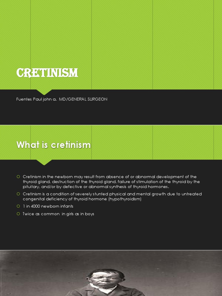 Cretinism | PDF | Hypothyroidism | Thyroid