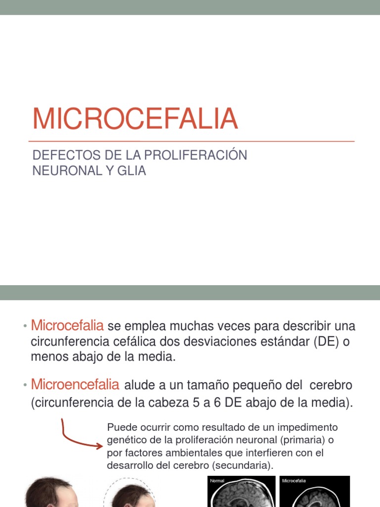 MICROCEFALIA | PDF | Parálisis cerebral | Cerebro
