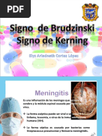 Signos Meningeos | PDF | Sistema musculoesquelético | Anatomía humana