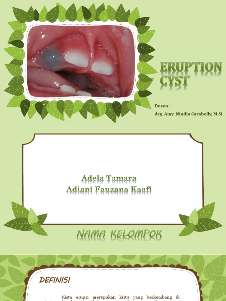 ERUPTION CYST: A BRIEF OVERVIEW | PDF