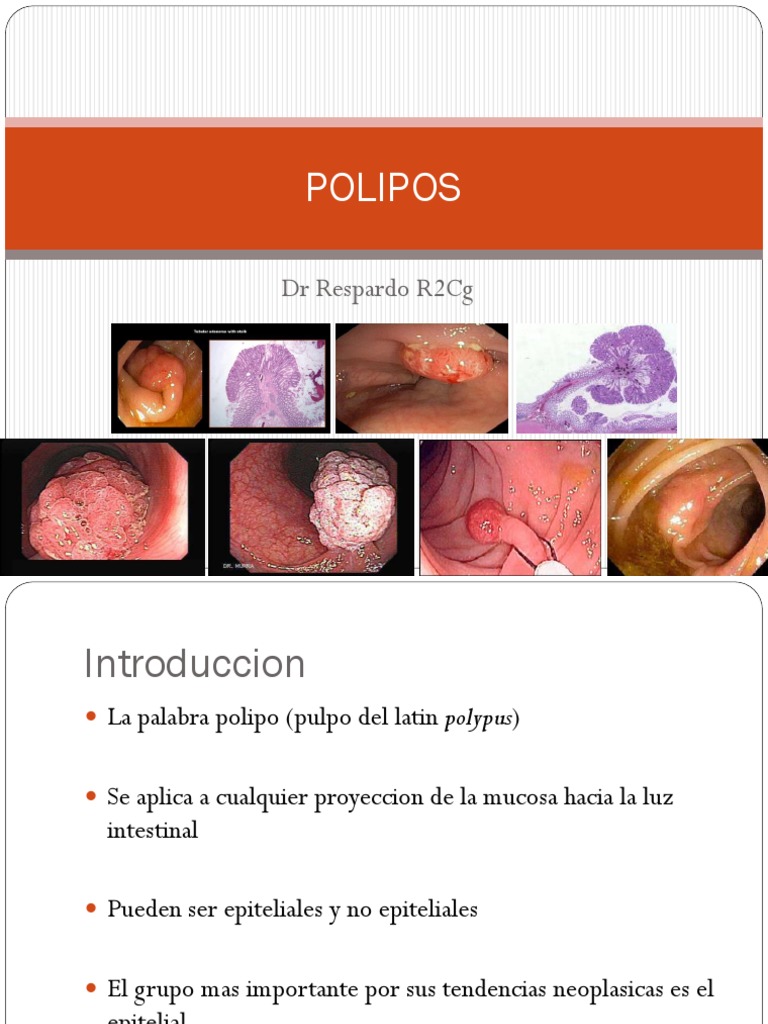 Polipos 130129224134 Phpapp02 | PDF | Cáncer colonrectal | Enfermedades ...