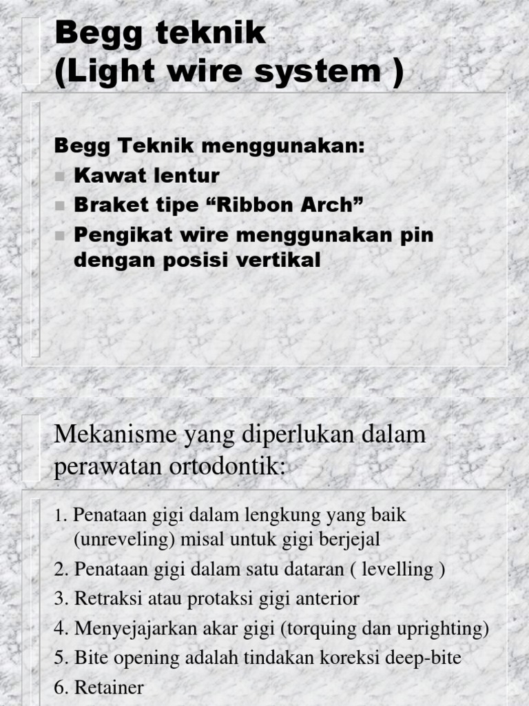 Begg Technique | PDF