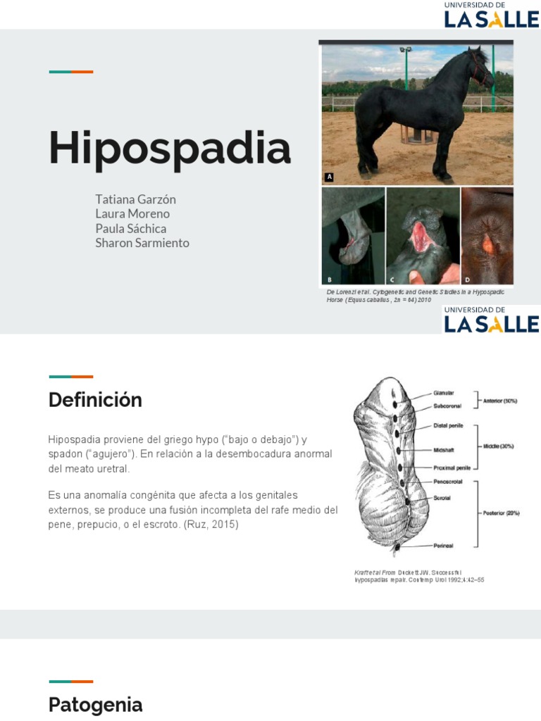Hipospadia: Definición y Tratamiento | PDF | Anatomia sexual | Sistema ...