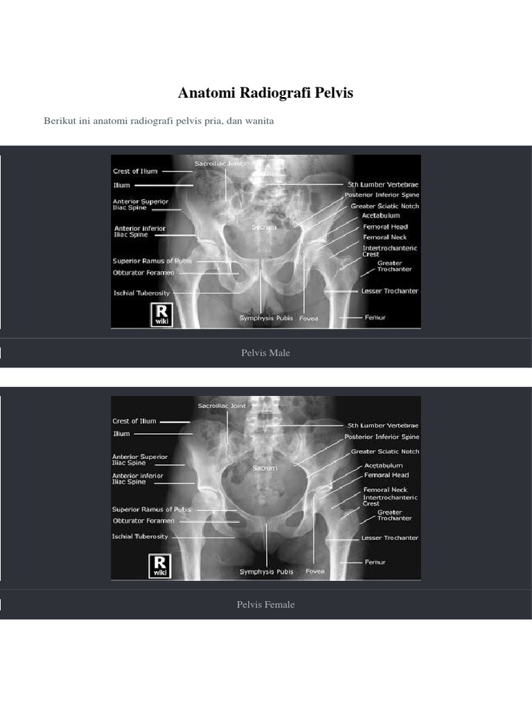 Anatomi Radiografi Pelvis | PDF