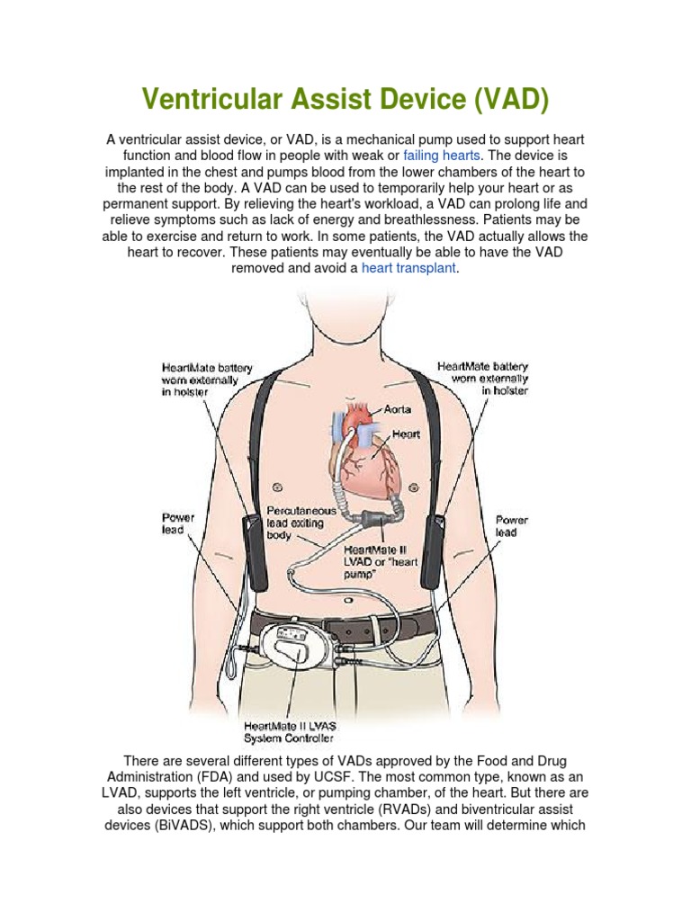 Understanding Ventricular Assist Devices | PDF | Heart | Cardiovascular ...