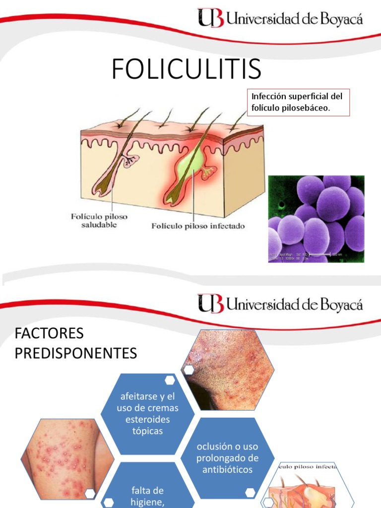 Foliculitis y forunculosis: causas y tratamiento | PDF | Ántrax ...