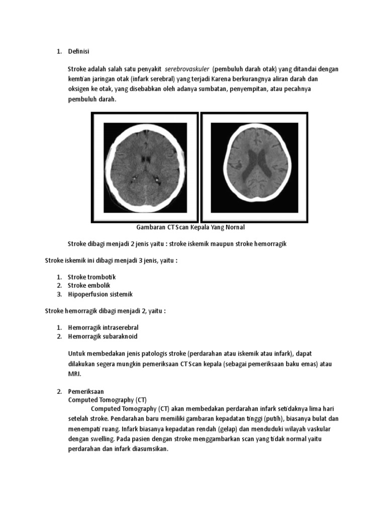 Tugas Radiologi Serebrovaskular CT Scan | PDF