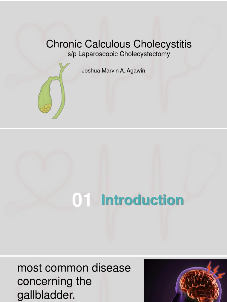 Chronic Calculous Cholecystitis | Medicine | Health Sciences
