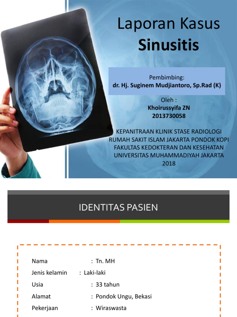Sinusitis Maksilaris Dextra: Diagnosis dan Penatalaksanaan | PDF
