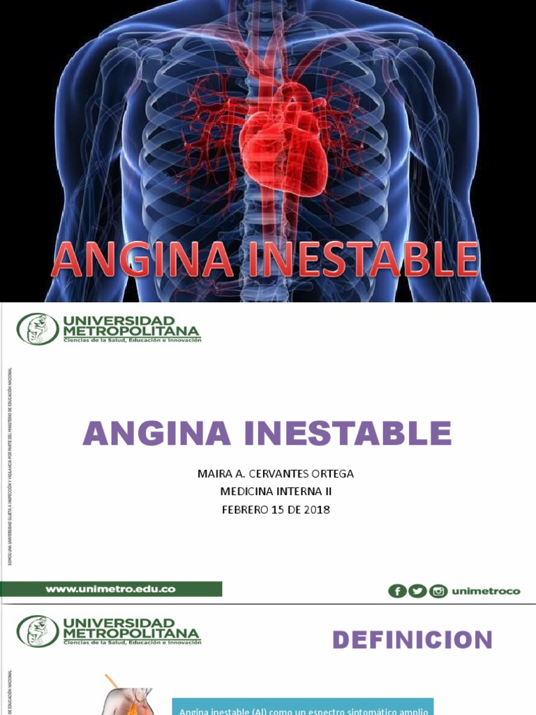 Angina Inestable | PDF | Infarto de miocardio | Electrocardiografia